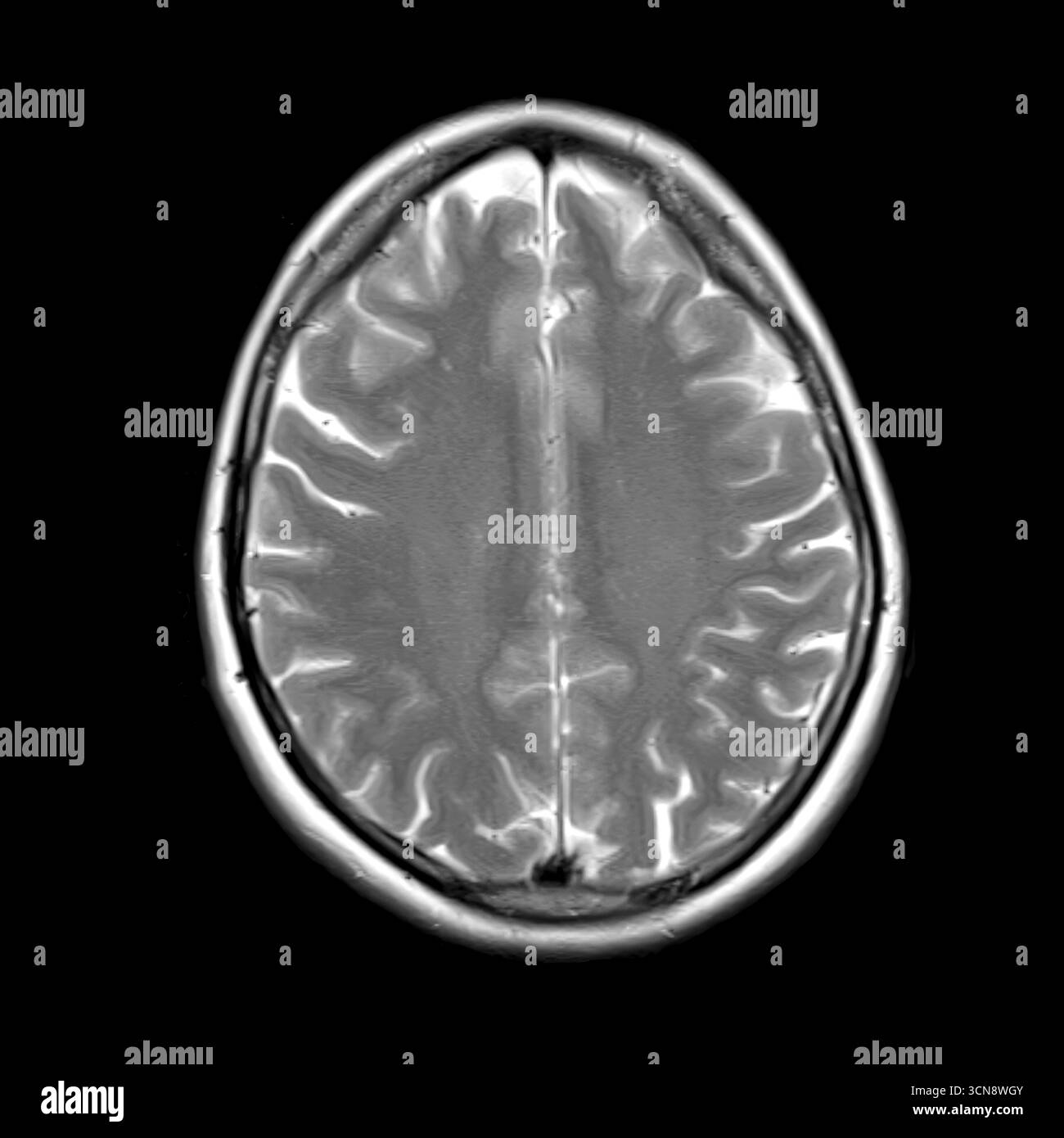 Symmetrical anatomy Black and White Stock Photos & Images - Alamy