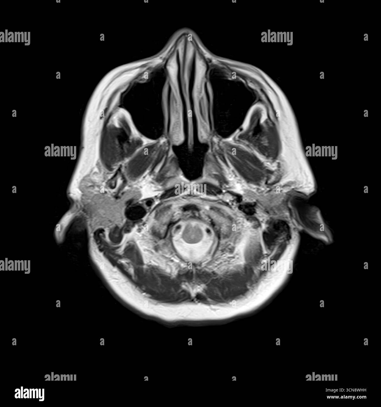 Medulla anatomy Black and White Stock Photos & Images - Alamy