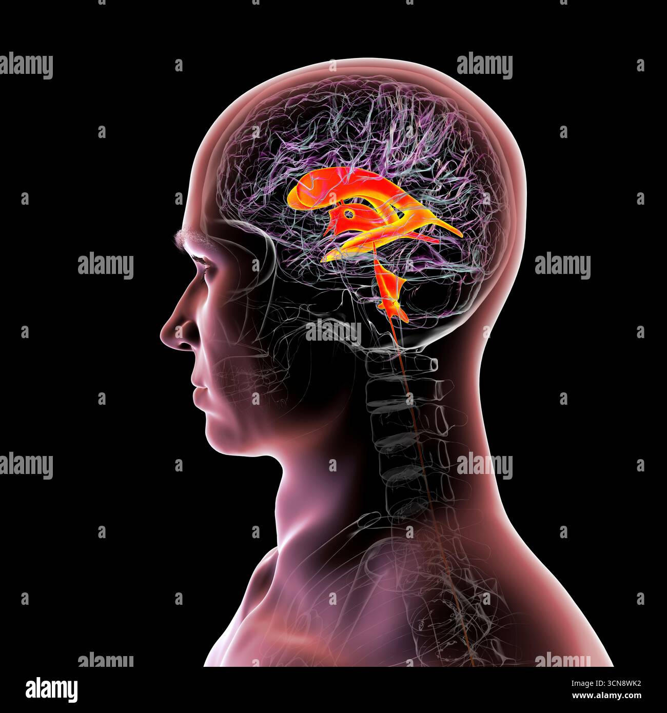 Illustration of the ventricular system of the brain. The ventricles are ...