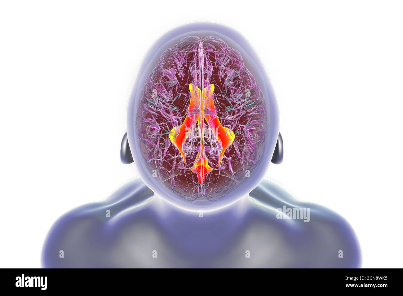 Illustration of the ventricular system of the brain. The ventricles are ...