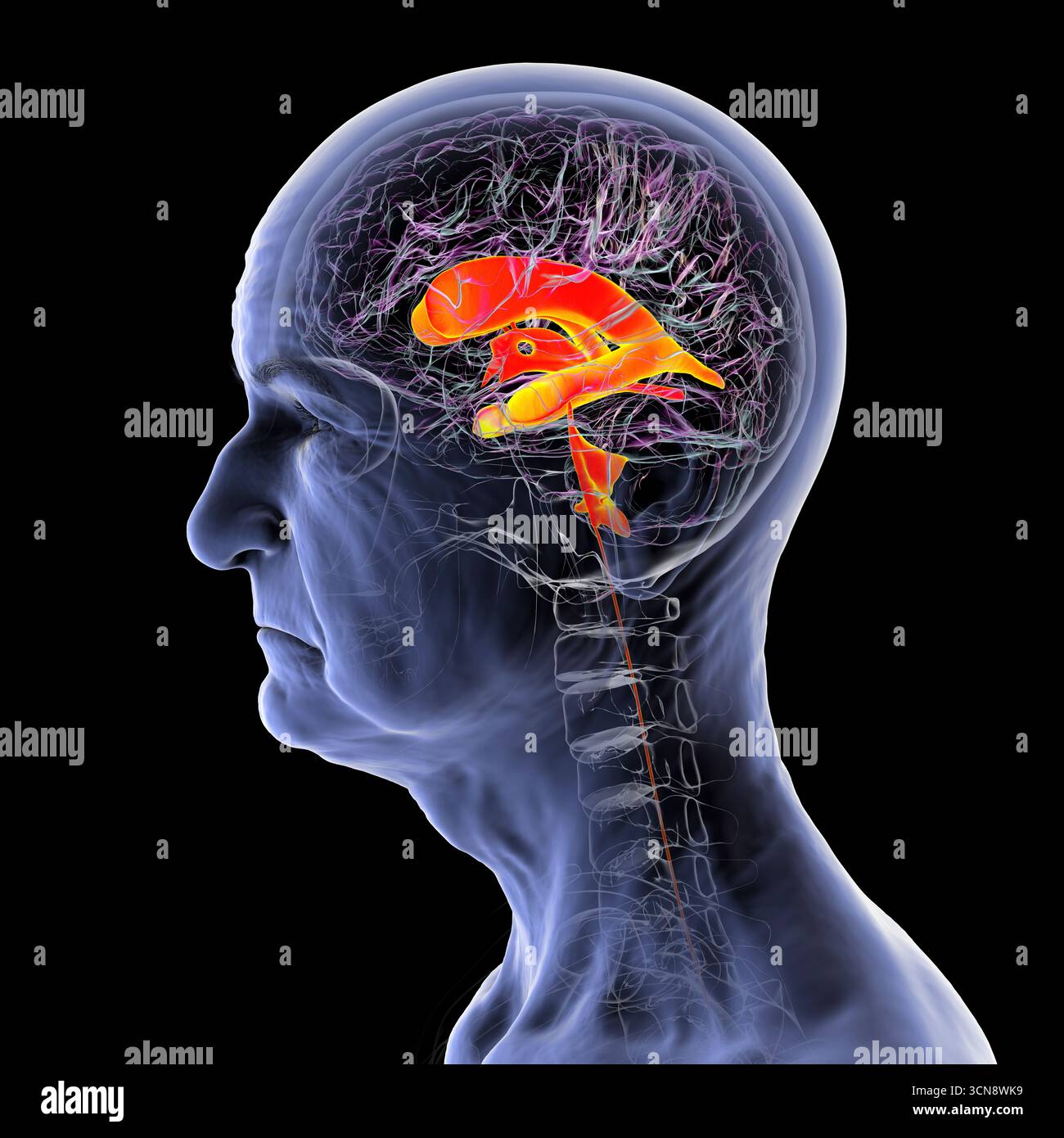 Illustration of the ventricular system of the brain in a senior person ...