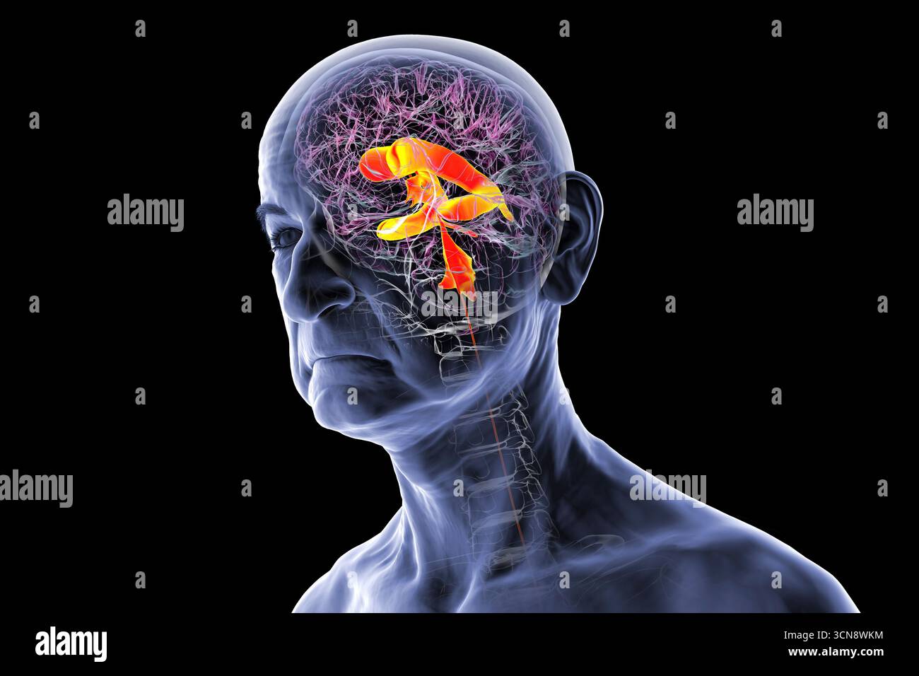 Illustration of the ventricular system of the brain in a senior person ...