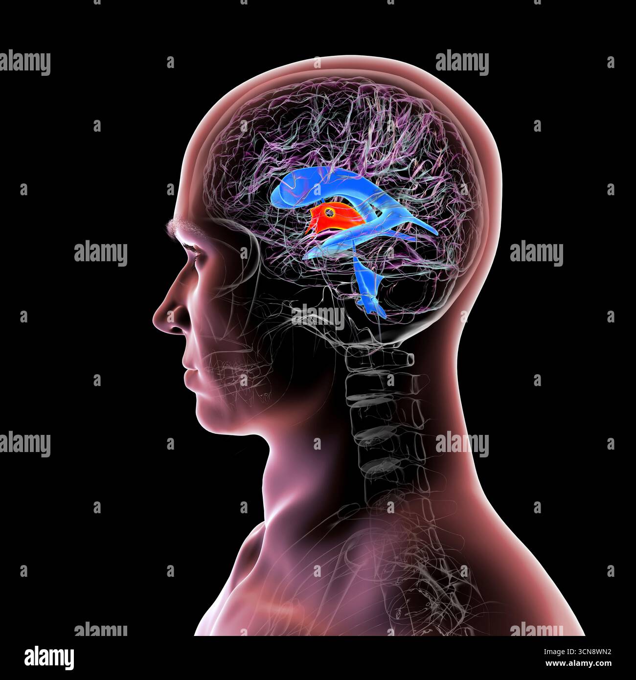 Illustration of the third brain ventricle (red) and ventricular system ...