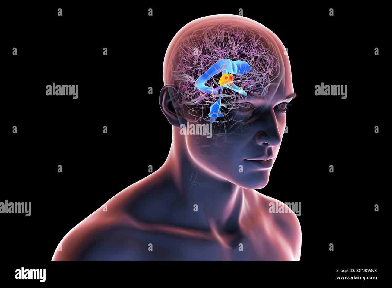Illustration of the third brain ventricle (red) and ventricular system ...