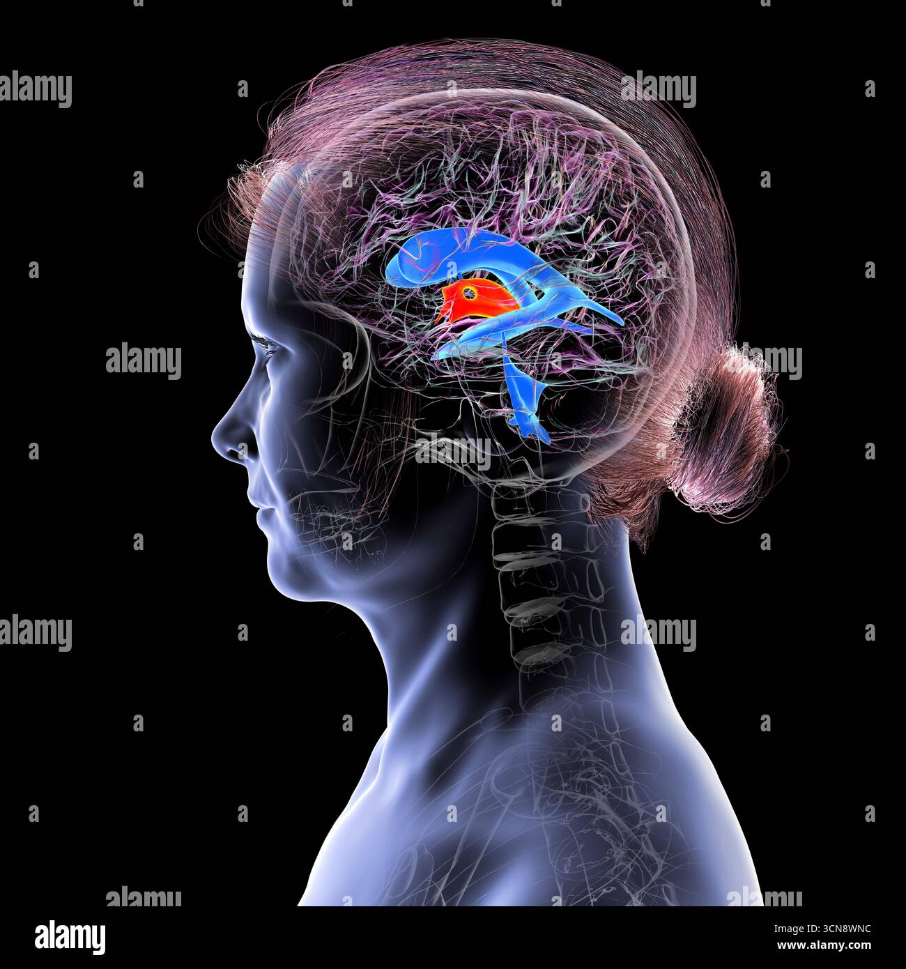 Illustration of the third brain ventricle (red) and ventricular system ...