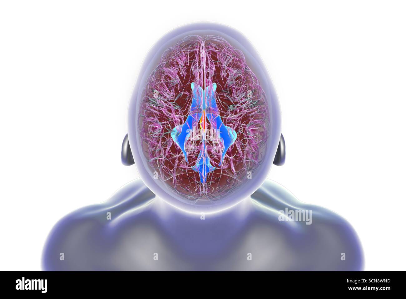 Illustration of the third brain ventricle (red) and ventricular system ...