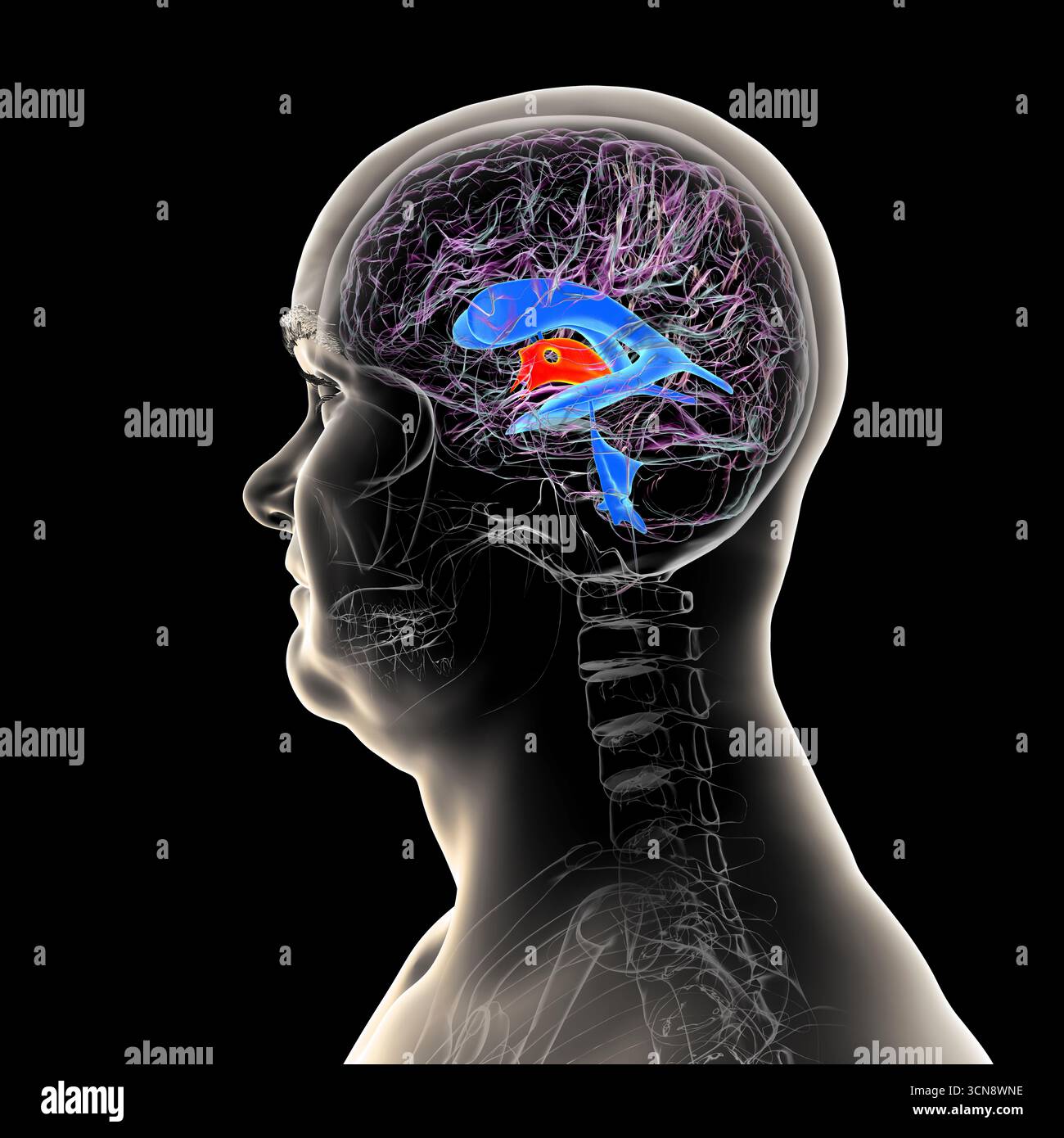 Illustration of the third brain ventricle (red) and ventricular system ...