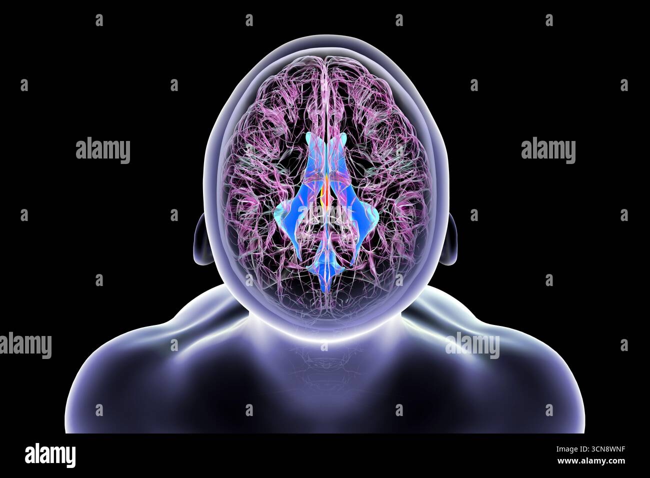 Illustration of the third brain ventricle (red) and ventricular system ...