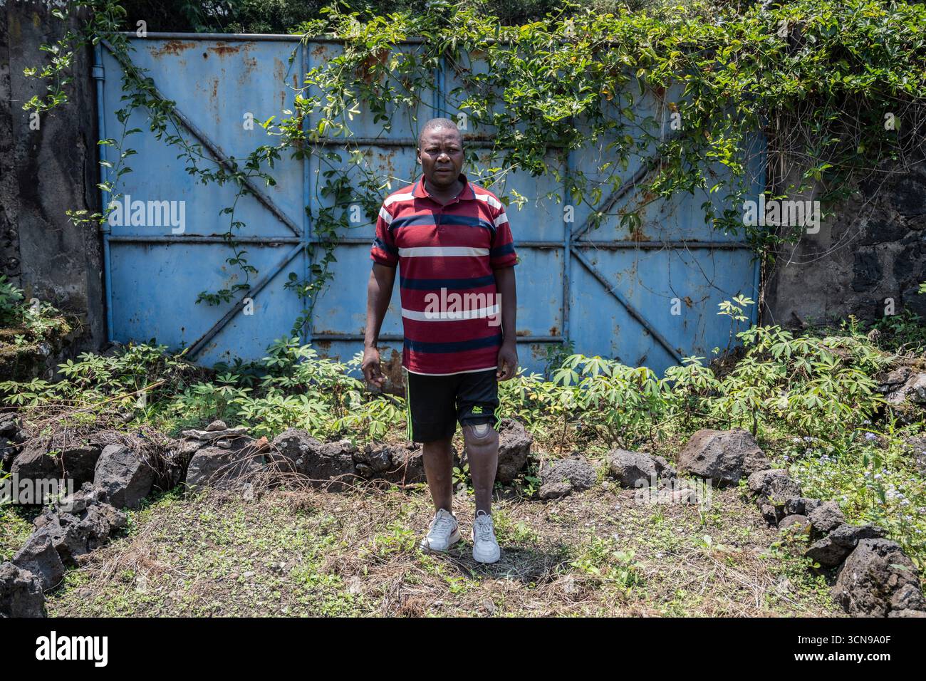 Jerome Jean-Claude Amani, one of many wounded by fighting in the region ...