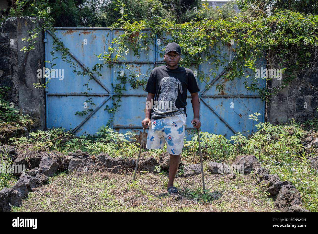 Faustin Amani, one of many wounded by fighting in the region, poses for ...