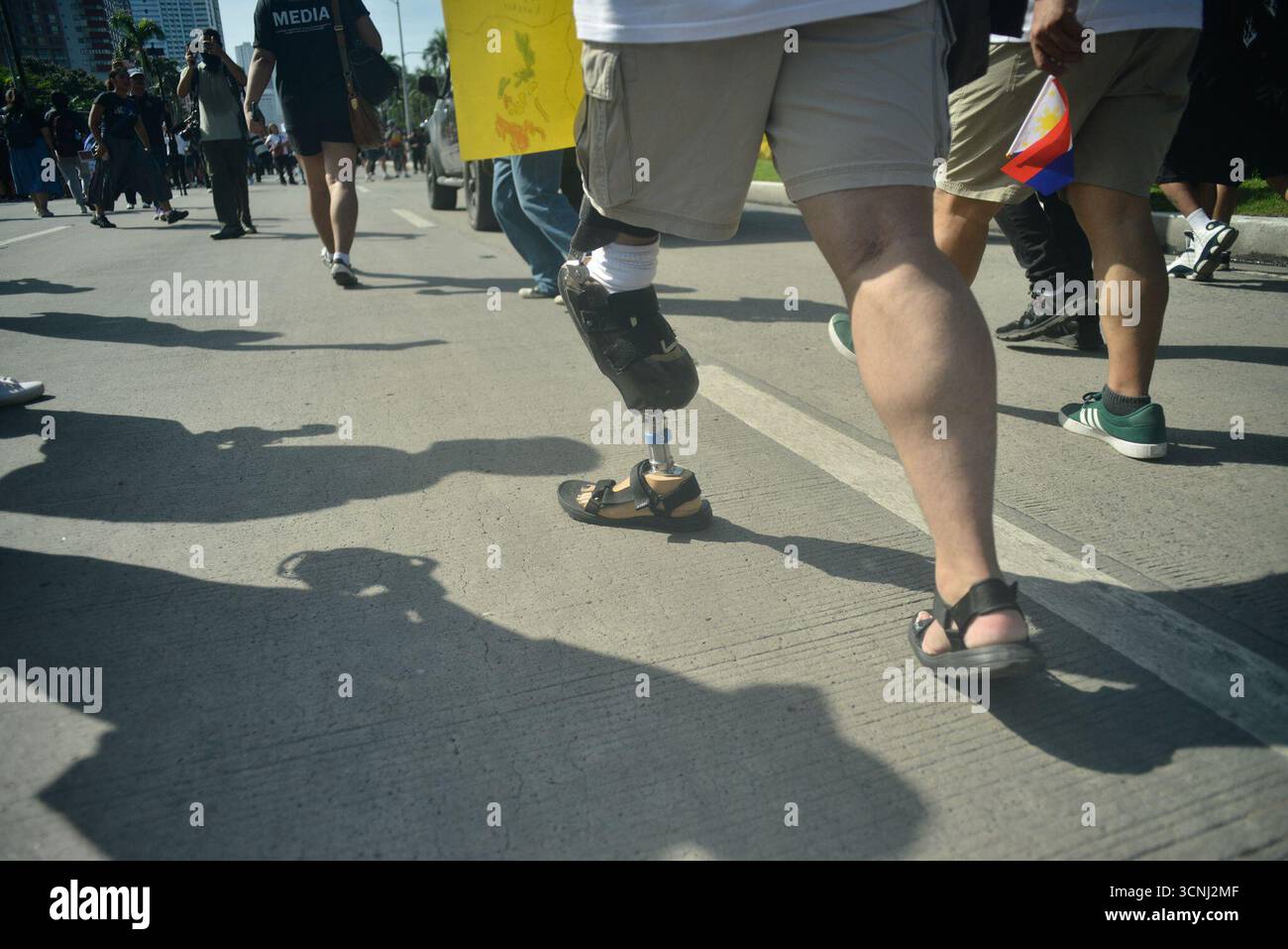 September 21, 2025, Manila, Ncr, Philippines: A man with a prothestic ...