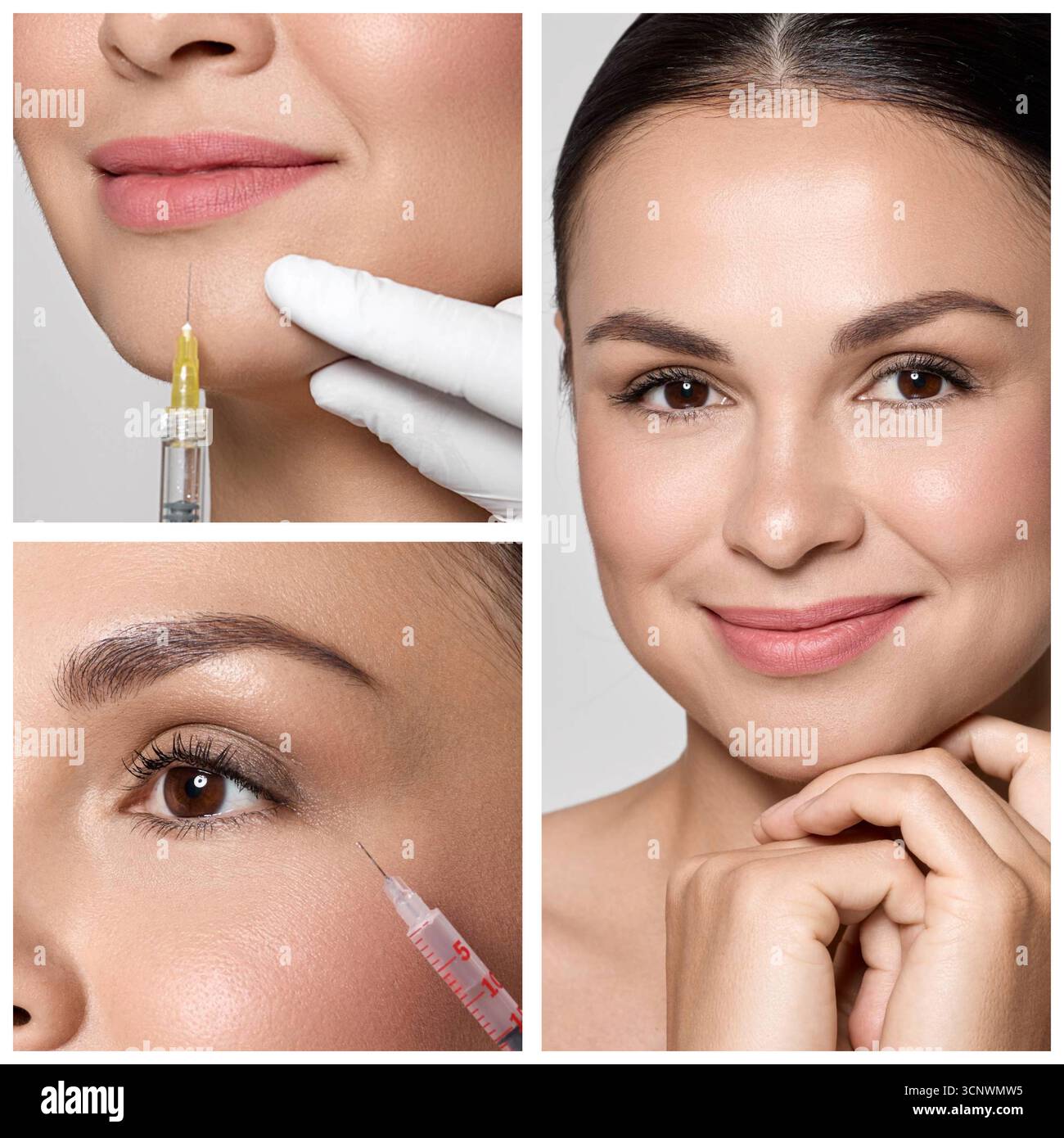 Cosmetic injection in eye Cut Out Stock Images & Pictures - Alamy