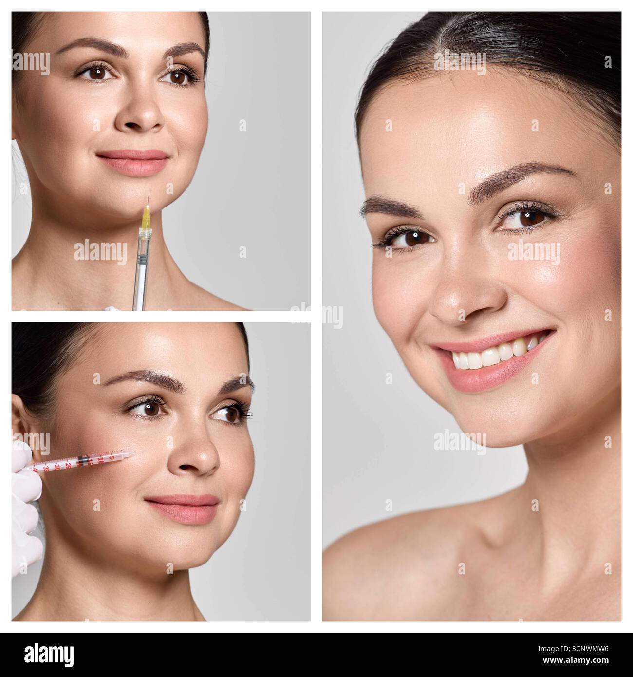 Chin botulinum toxin injection Cut Out Stock Images & Pictures - Alamy