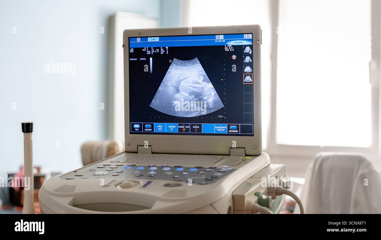 Sonographic image hi-res stock photography and images - Alamy