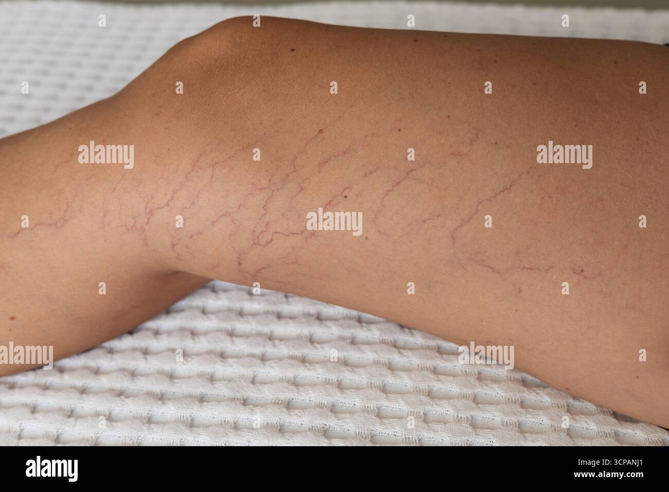 Close up tanned leg showing hi-res stock photography and images - Alamy