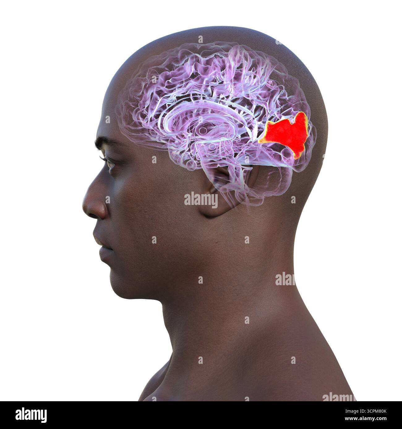 Illustration of a human brain with highlighted cuneus gyrus. This is a ...