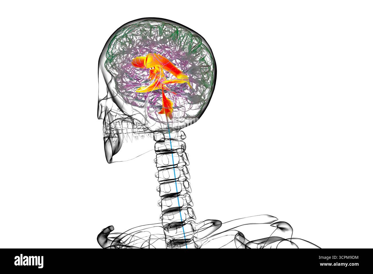 Ventricular system of the brain, illustration. The ventricles are ...
