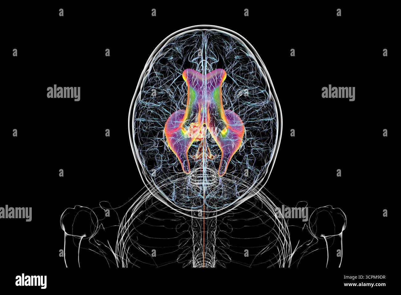 Three ventricles of the brain hi-res stock photography and images - Alamy