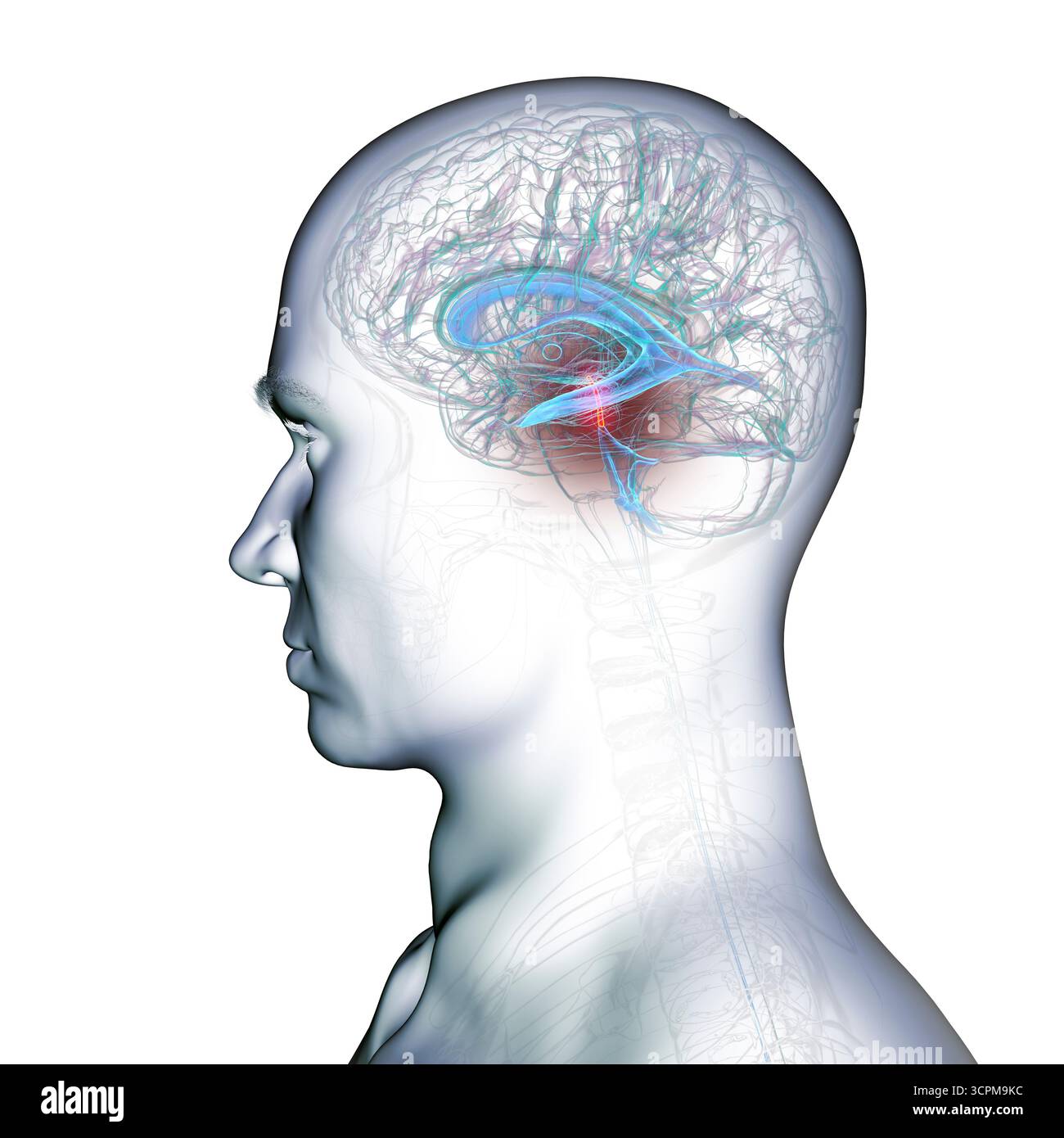 Illustration of a brain with highlighted cerebral aqueduct (red) and ...