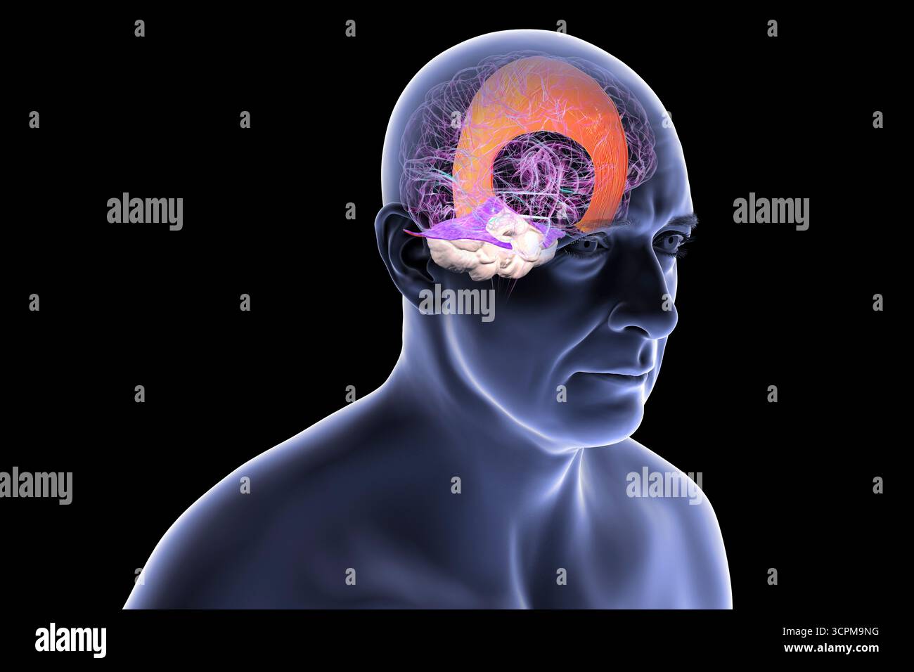 Illustration of a human brain with highlighted falx cerebri and ...