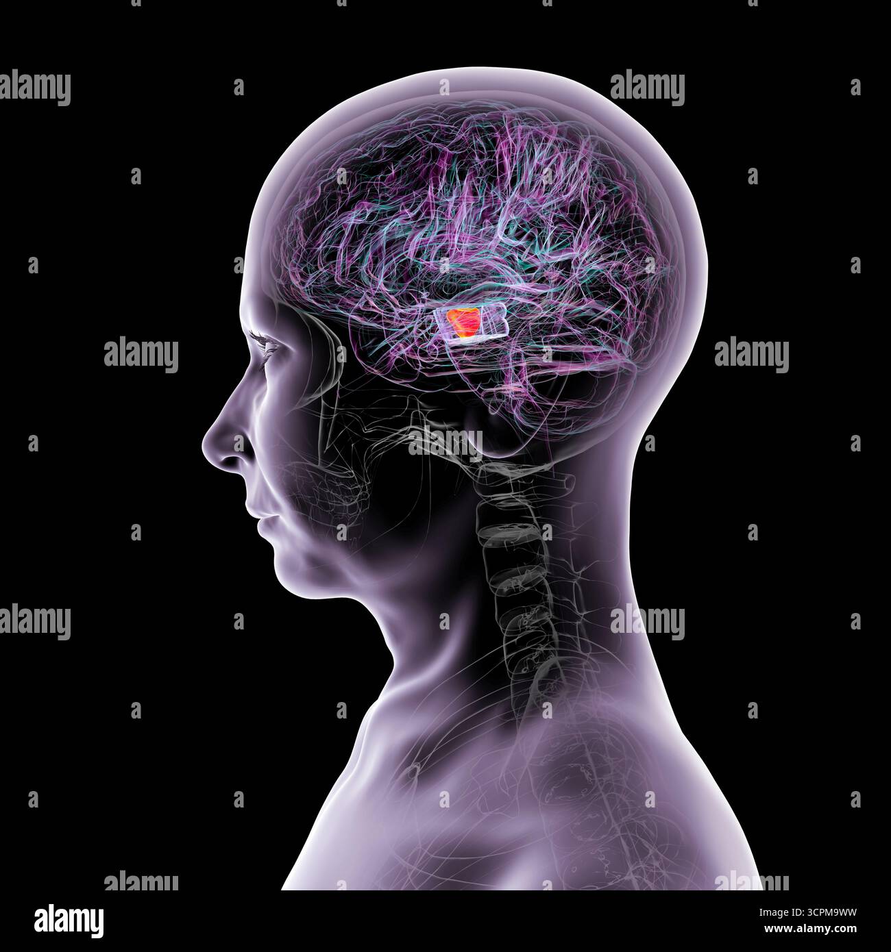 Illustration of a human brain with highlighted substantia nigra in the ...