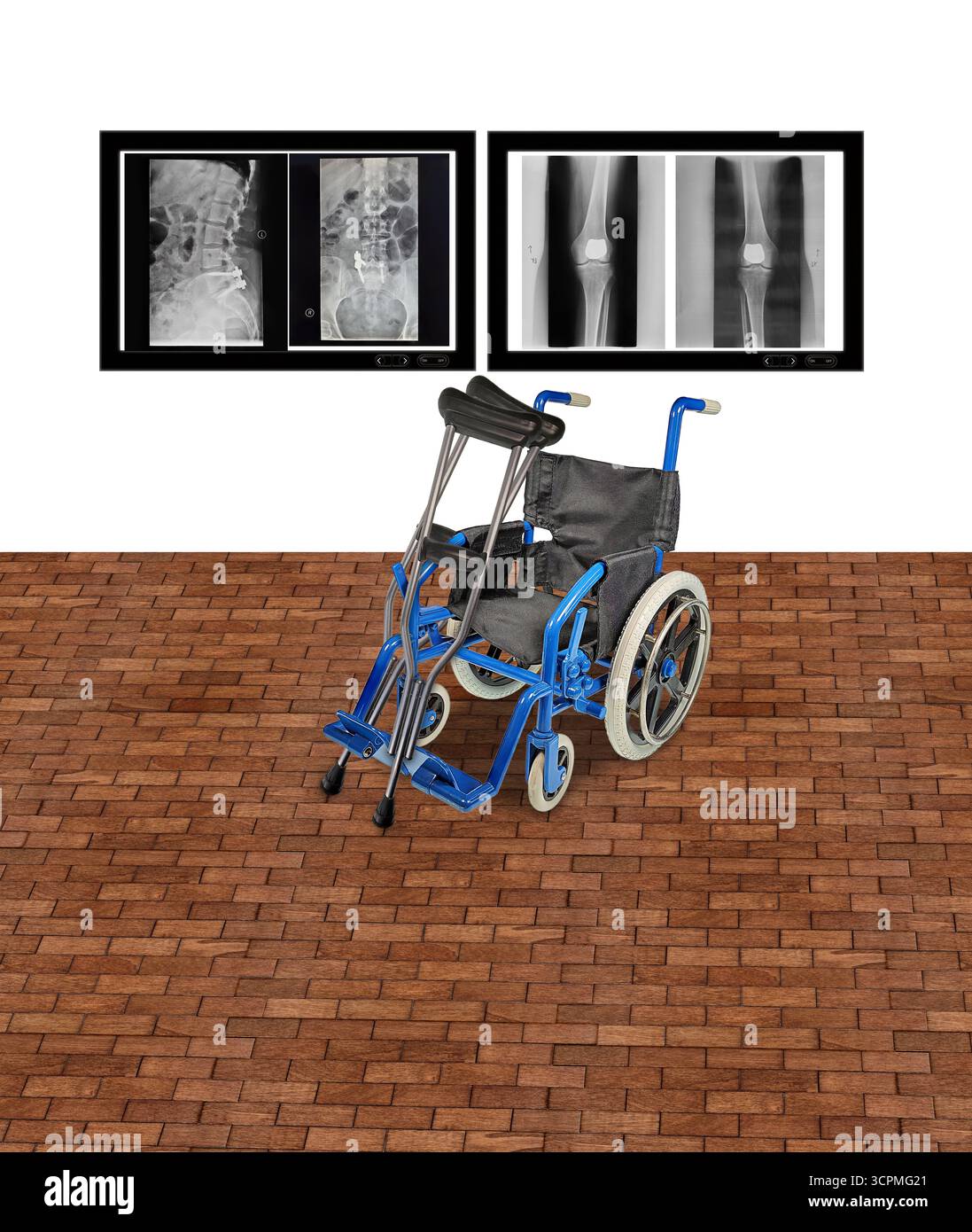 X-Rays show the internal bone structure of the body that have issues ...