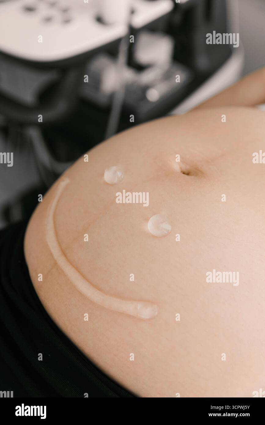 Doctor applies ultrasound gel in smiley shape on pregnant belly before ...