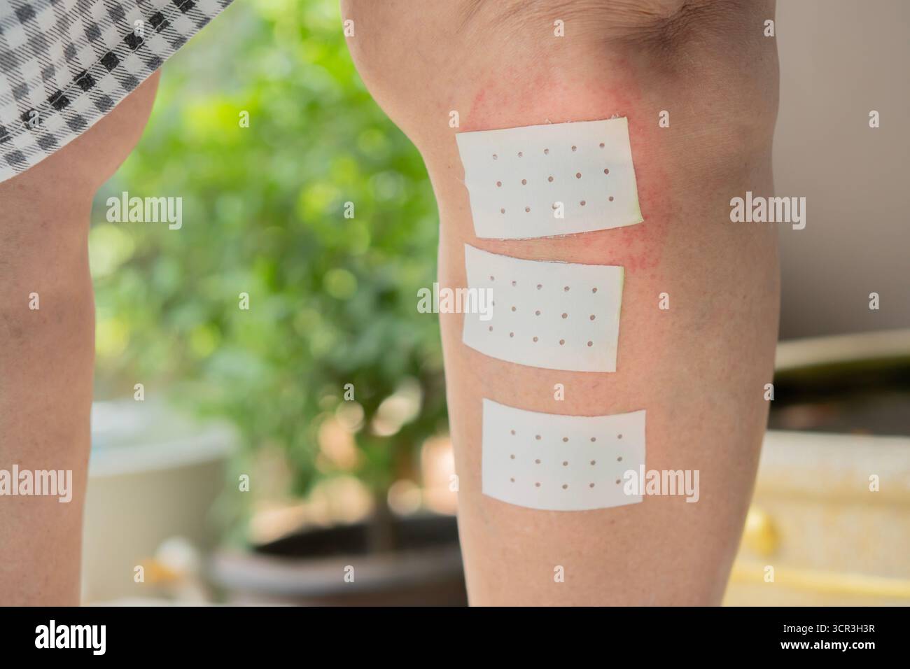 Kinesiology white taping on the old age human leg at outdoor. Solution ...
