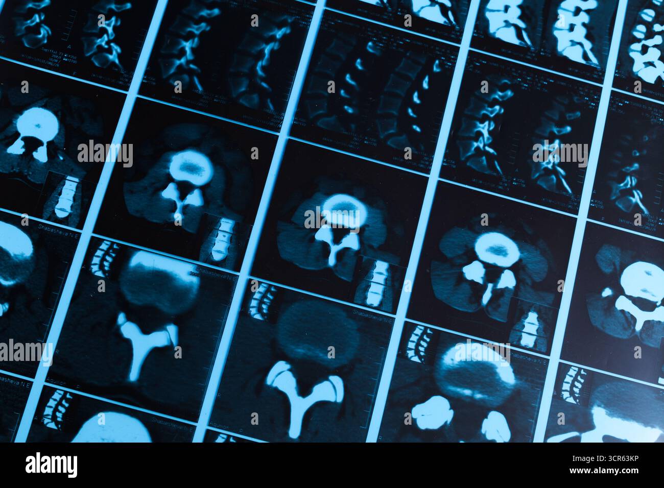 Medical imaging display shows detailed cross-sections of the human ...