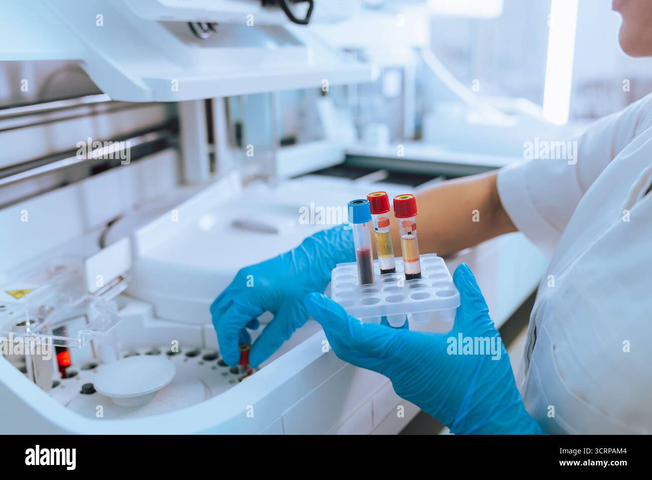 Automatic blood test analyzer hi-res stock photography and images - Alamy