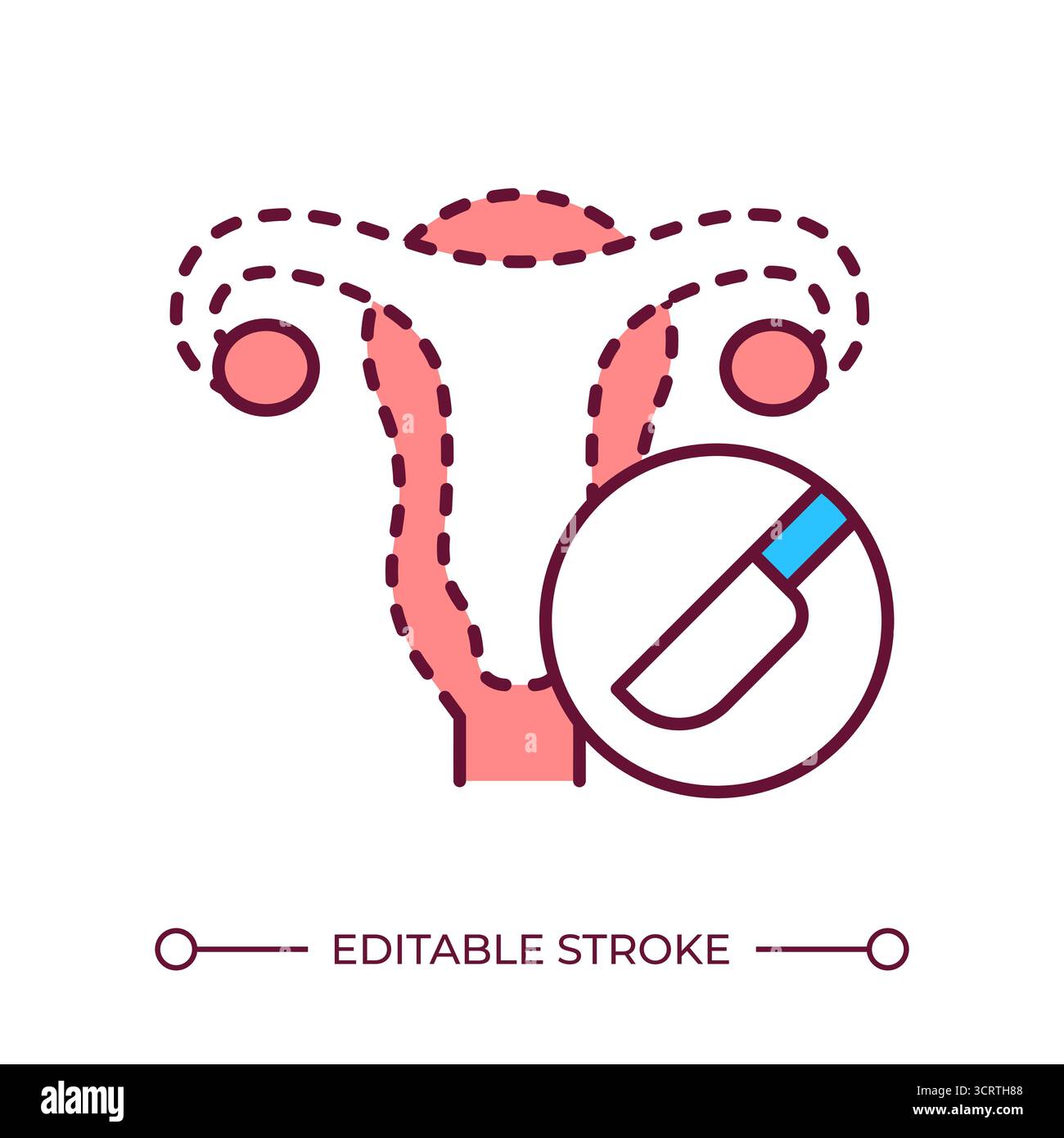 Uterine prolapse hi-res stock photography and images - Alamy
