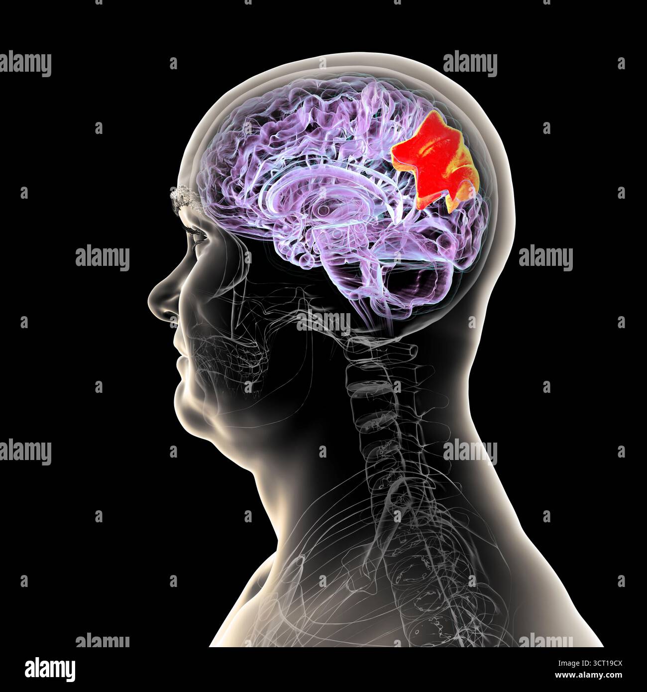 Human brain with highlighted precuneus gyrus hi-res stock photography ...