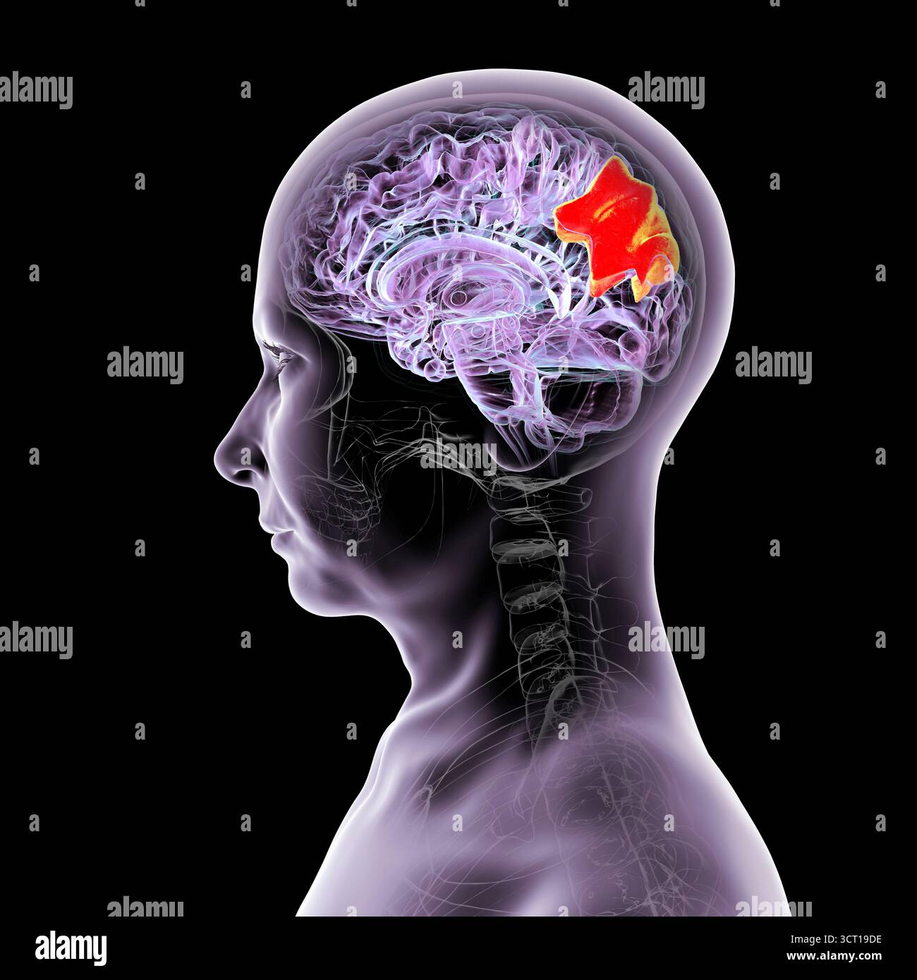 Human brain with highlighted precuneus gyrus hi-res stock photography ...