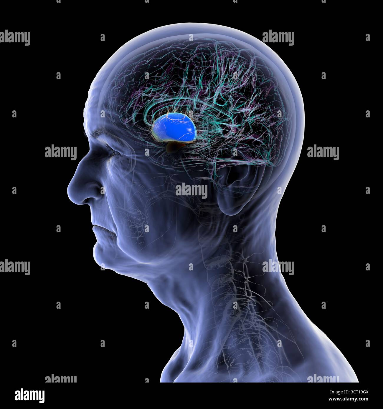 Illustration of an elderly human brain with highlighted putamen (blue ...