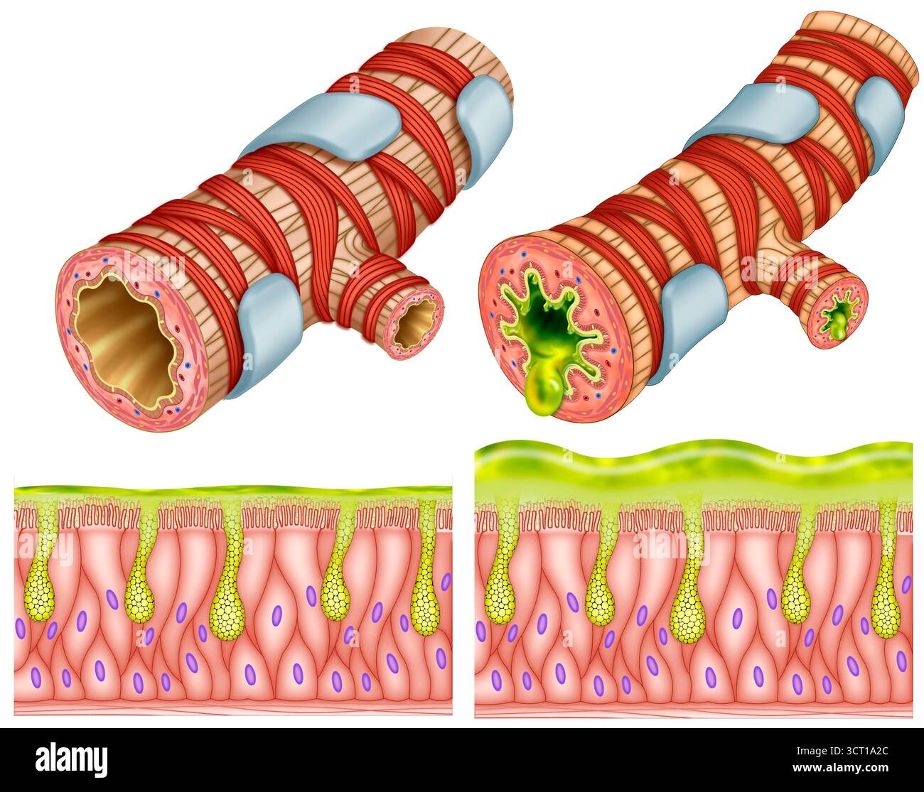 Illustration shows two schematic hi-res stock photography and images ...