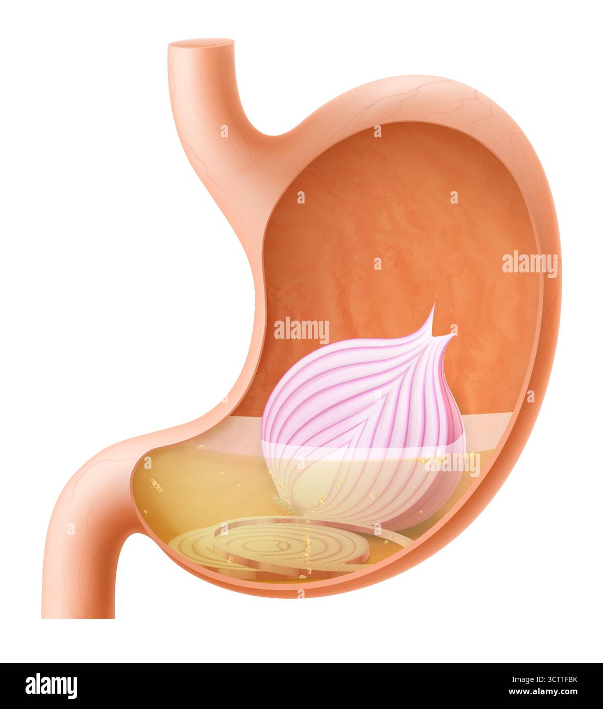 Human Stomach with onion. The stomach digests red onion. A stomach ...