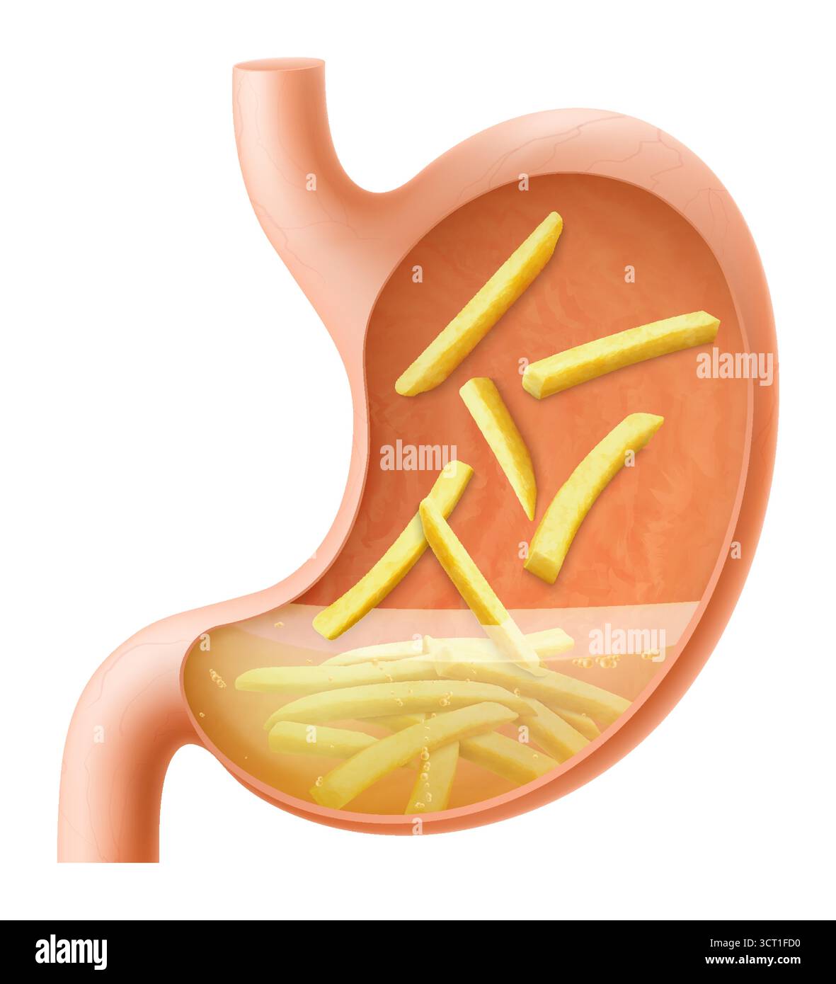 Human Stomach filled full by fast food. Gastric juice digesting French ...