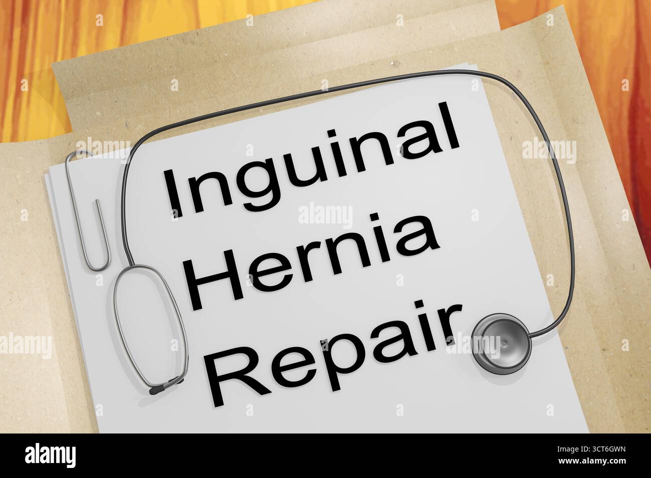 Premalene hi-res stock photography and images - Alamy