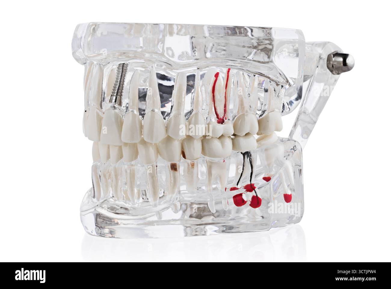 Healthy lower teeth Cut Out Stock Images & Pictures - Alamy