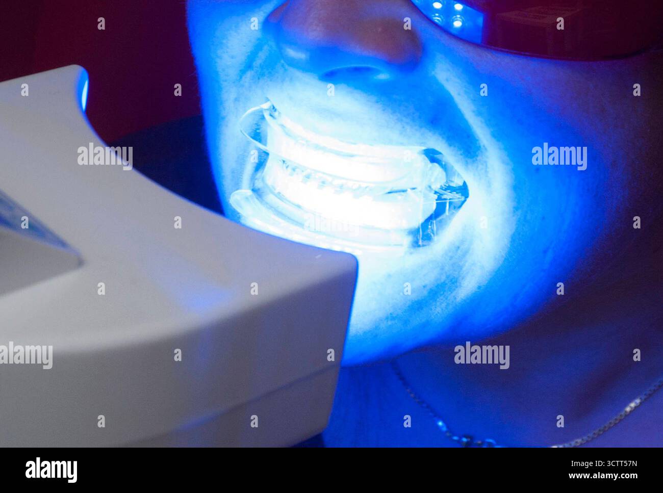 tooth color of human teeth or dentition at the dentist tooth color of ...