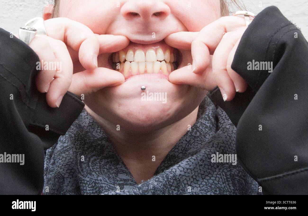 tooth color of human teeth or dentition at the dentist tooth color of ...