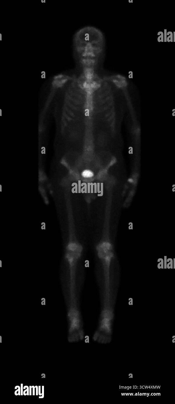 Body scan radioactive Black and White Stock Photos & Images - Alamy