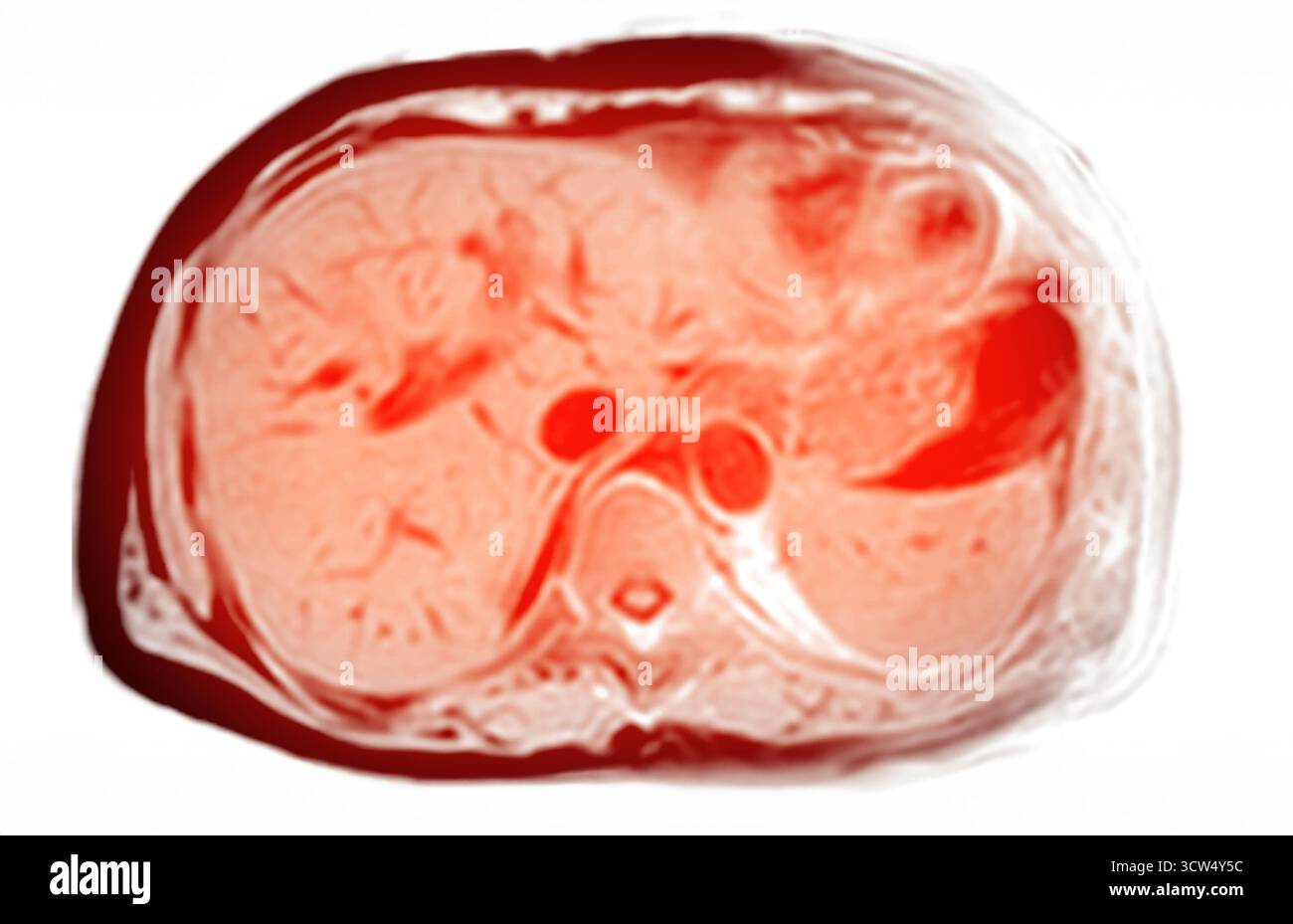 High resolution mri hi-res stock photography and images - Alamy