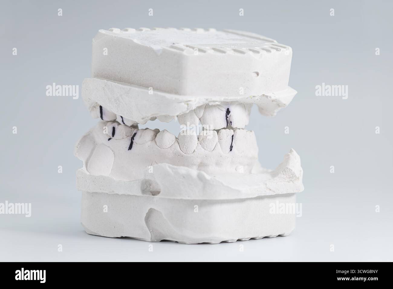 Detailed plaster dental model showing occlusal contact points used for ...