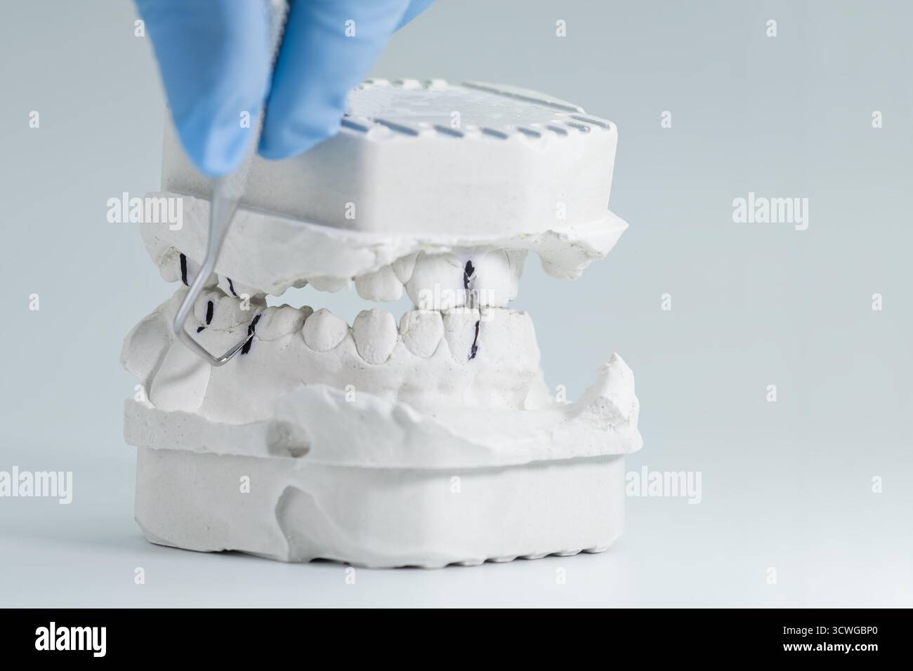 Gloved hand using a dental explorer tool to examine a full upper and ...