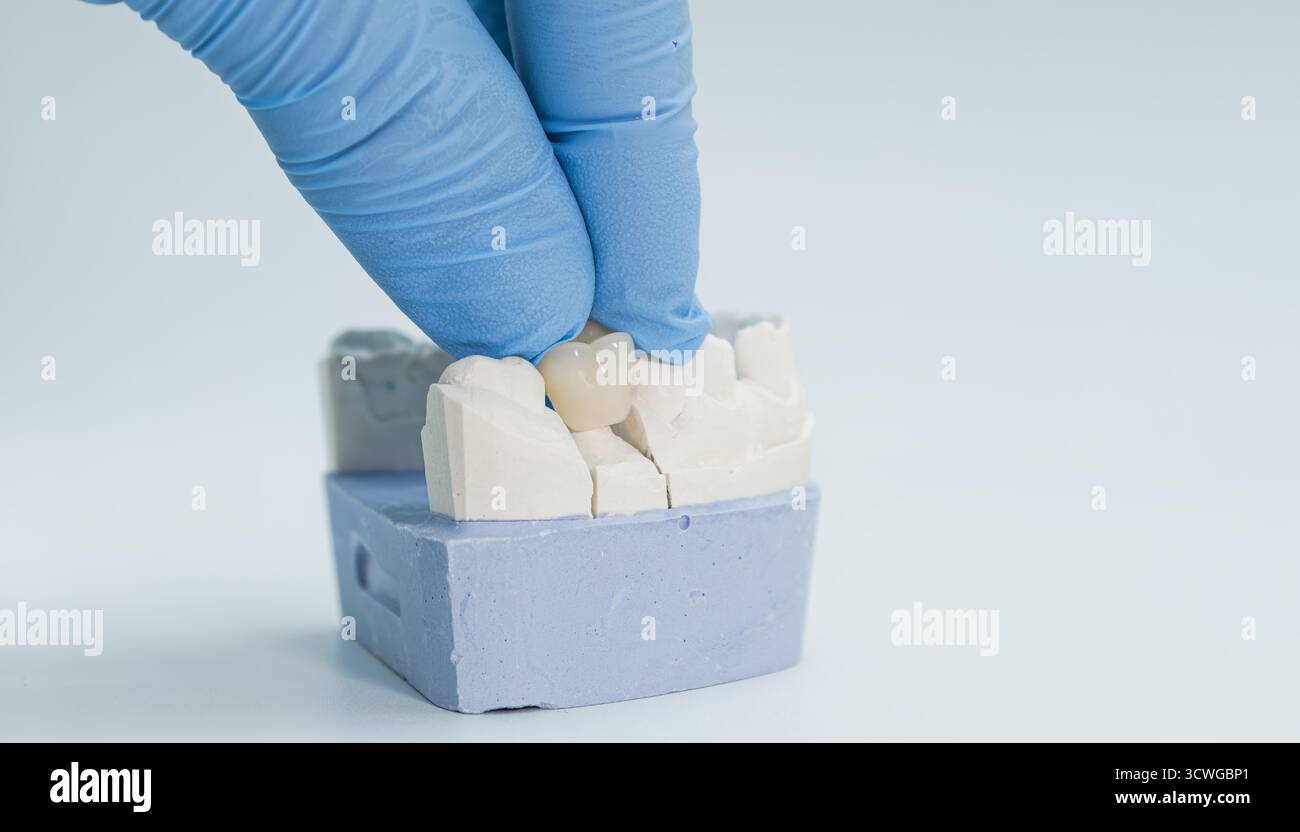 Jaw placing implant simulation hi-res stock photography and images - Alamy