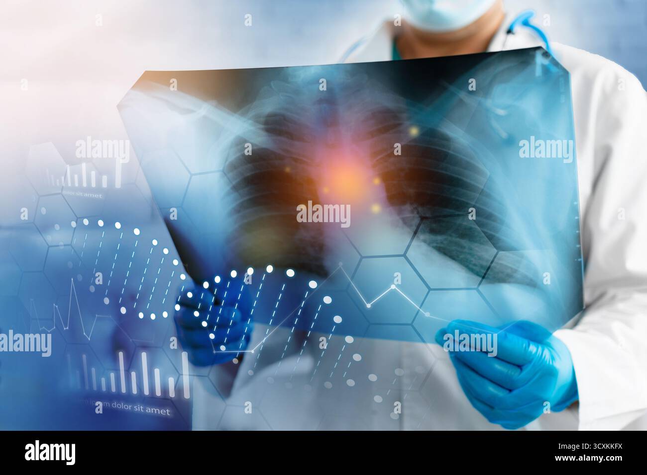 Doctor examines chest X-ray with digital health data overlay in medical ...