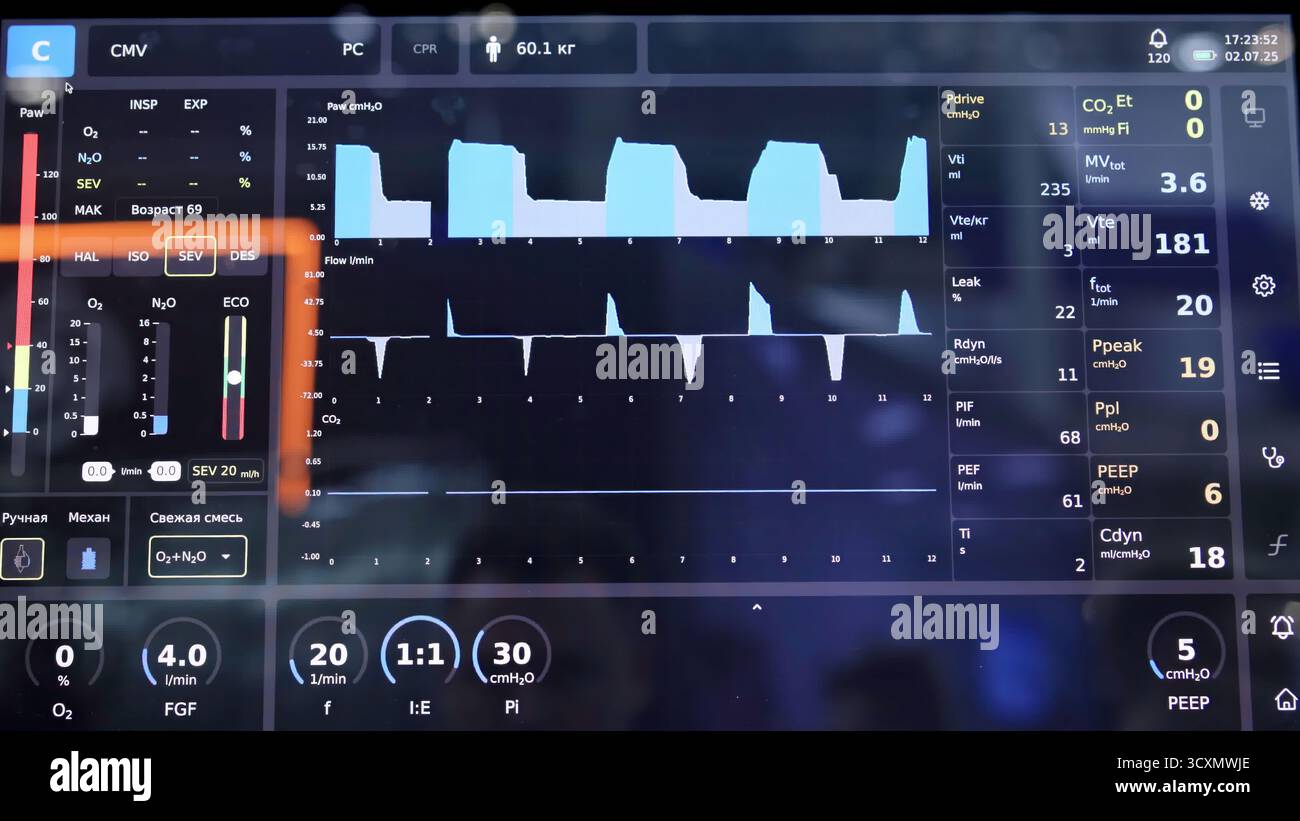 Medical ventilator screen showing hi-res stock photography and images ...