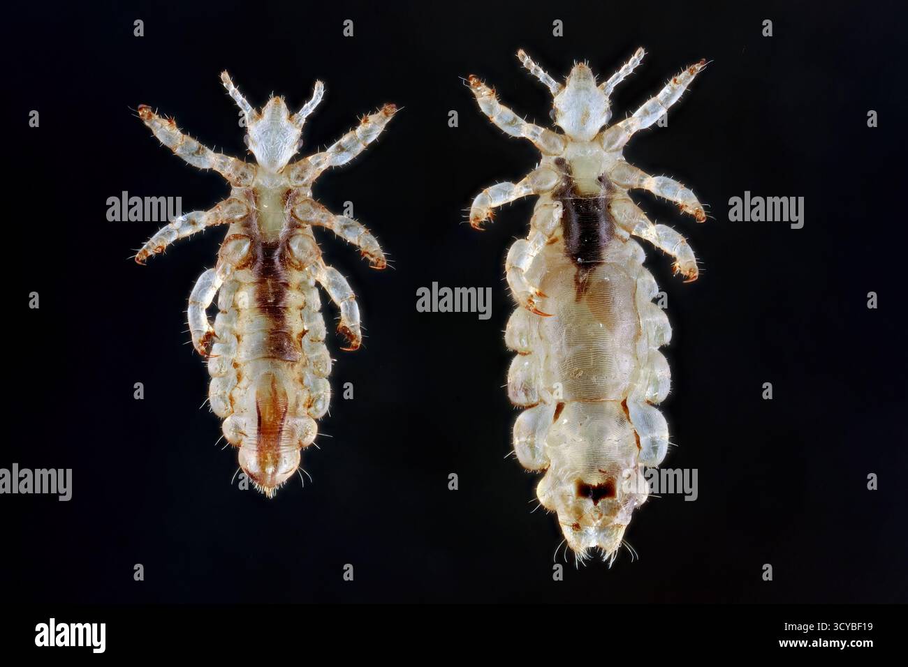 A detailed macro photo of body louse (Pediculus humanus) on a black ...