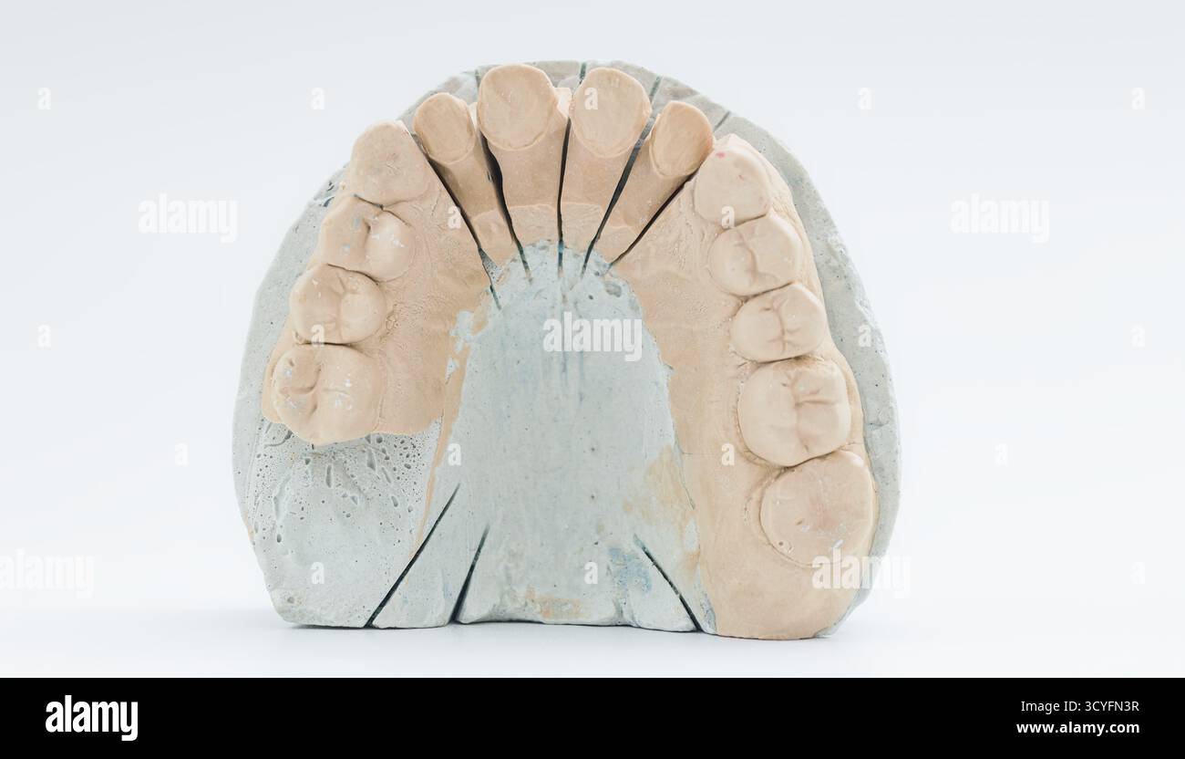Top-down view of a segmented plaster dental mold showing the upper arch ...